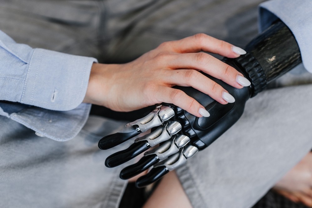 Finger prostheses in amputation claims: an update | Keoghs