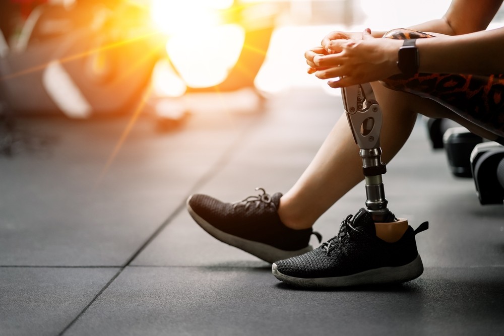 Limb amputation pain and the use of TMR: new NICE guidelines | Keoghs